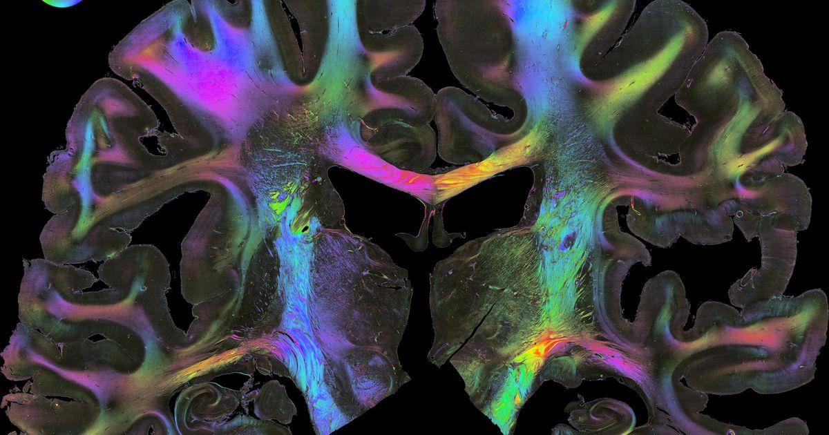 "A key for further brain research" - Helmholtz - Association of German ...